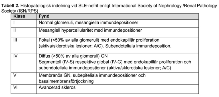 Riktlinjer för behandling av systemisk lupus erytematosus (SLE)